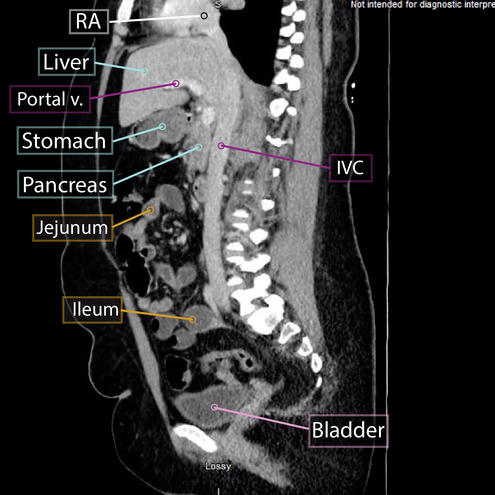 Advanced Anatomy & Physiology: Pancreas & Gallbladder | ditki medical ...