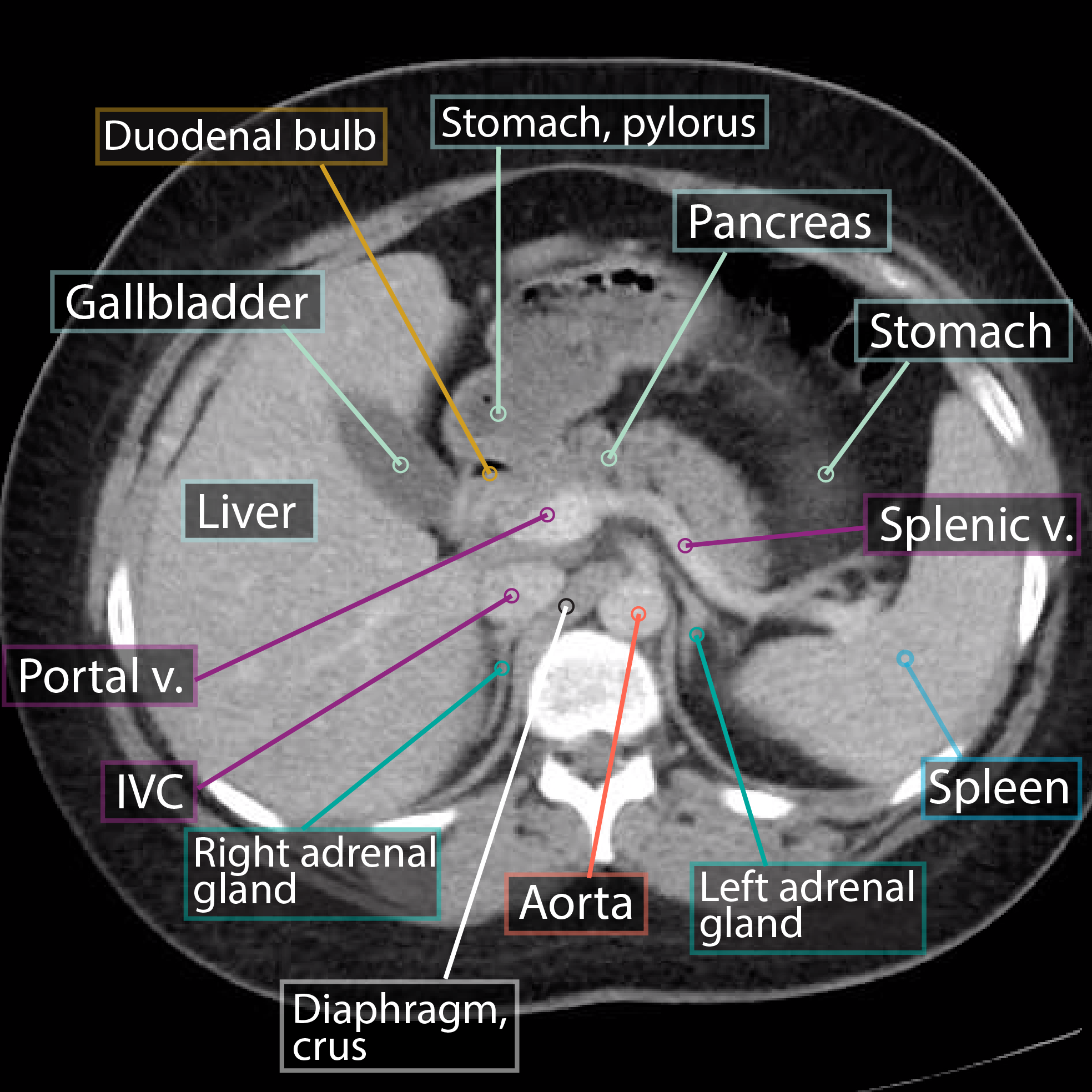 Advanced Anatomy & Physiology: Pancreas & Gallbladder | ditki medical ...