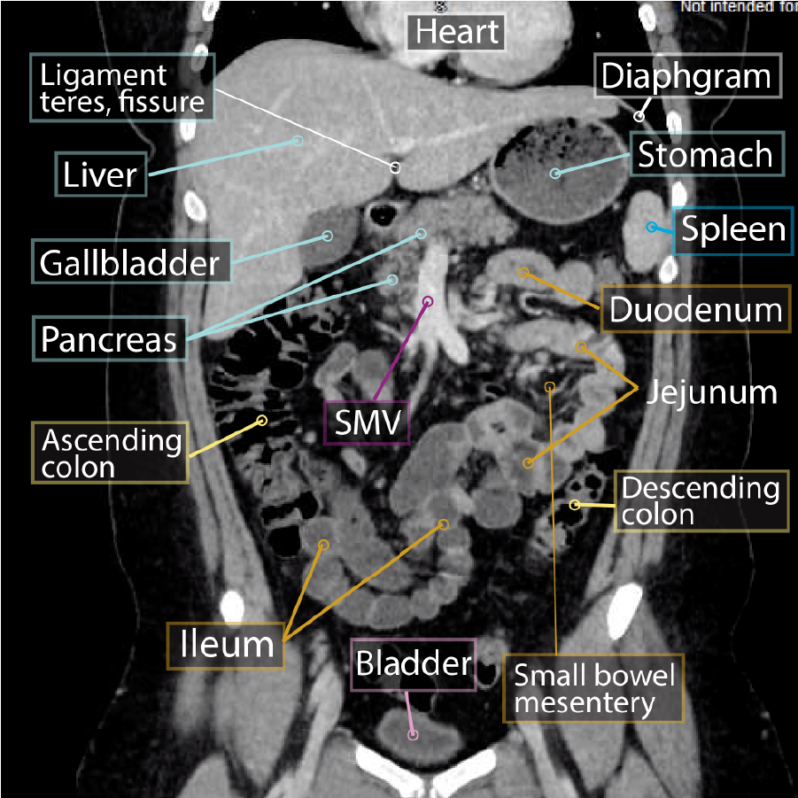 Advanced Anatomy & Physiology: Pancreas & Gallbladder | ditki medical & biological sciences