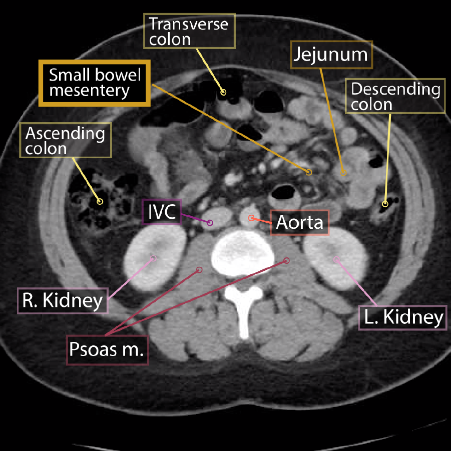 Gross Anatomy: Peritoneal Membranes | ditki medical & biological sciences
