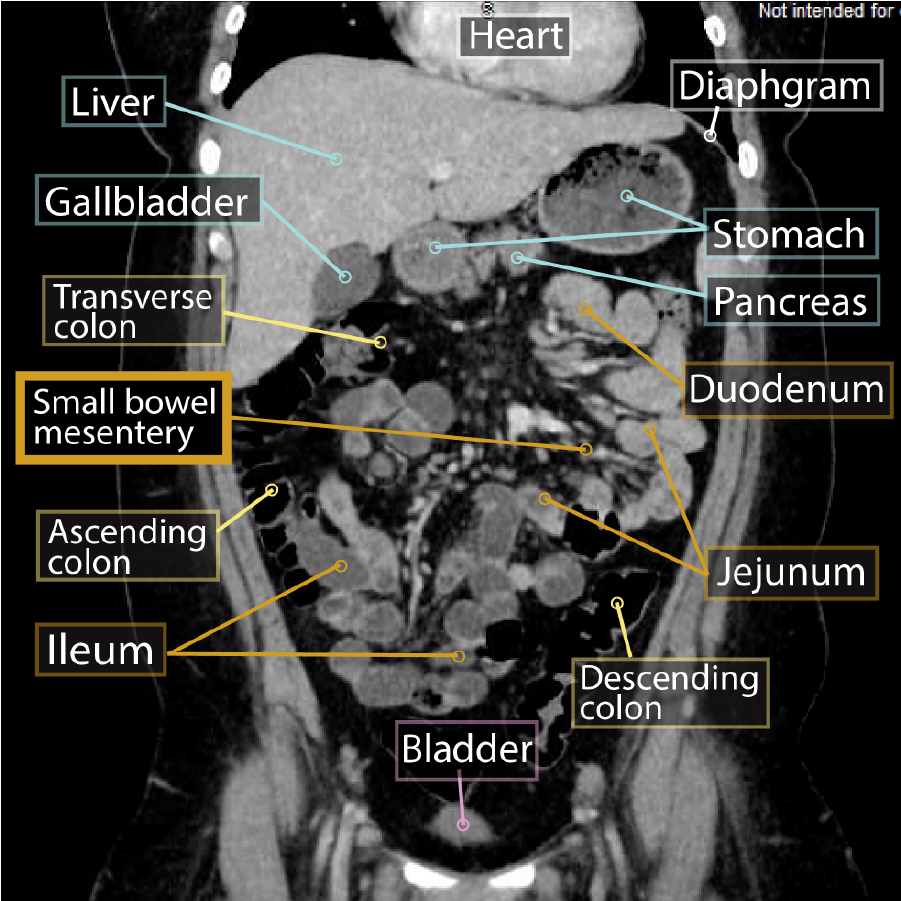 Gross Anatomy: Peritoneal Membranes | ditki medical & biological sciences