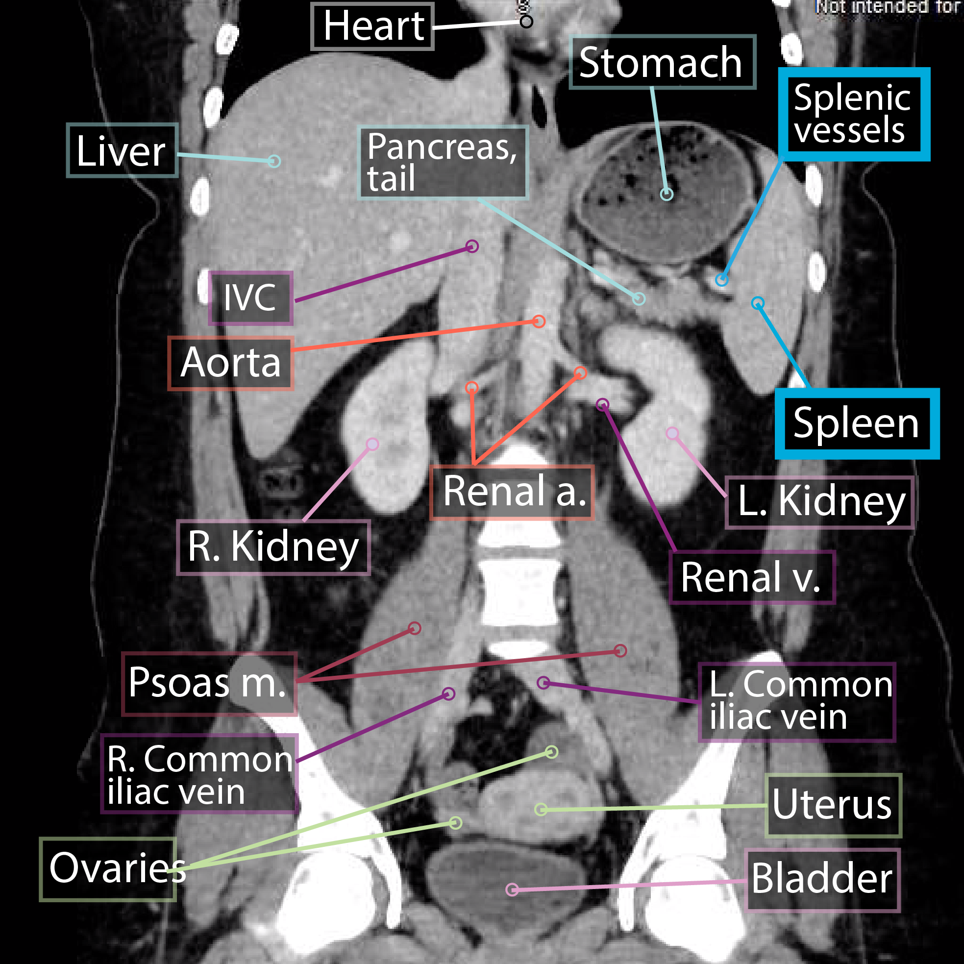 Advanced Anatomy & Physiology: Anatomic Planes & Body Movements | ditki ...