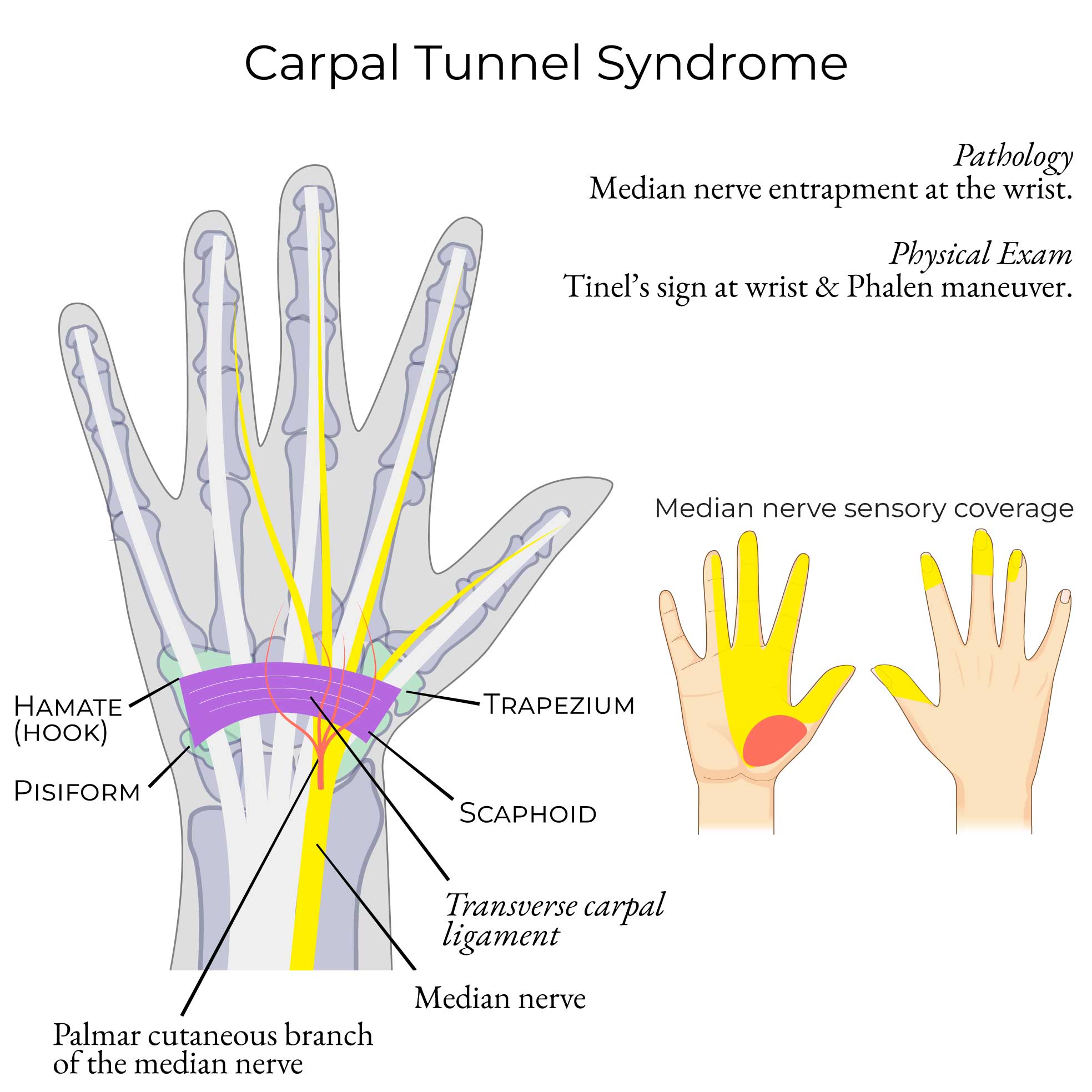 Clinical Medicine: Joint Injuries - Upper Limb | ditki medical ...