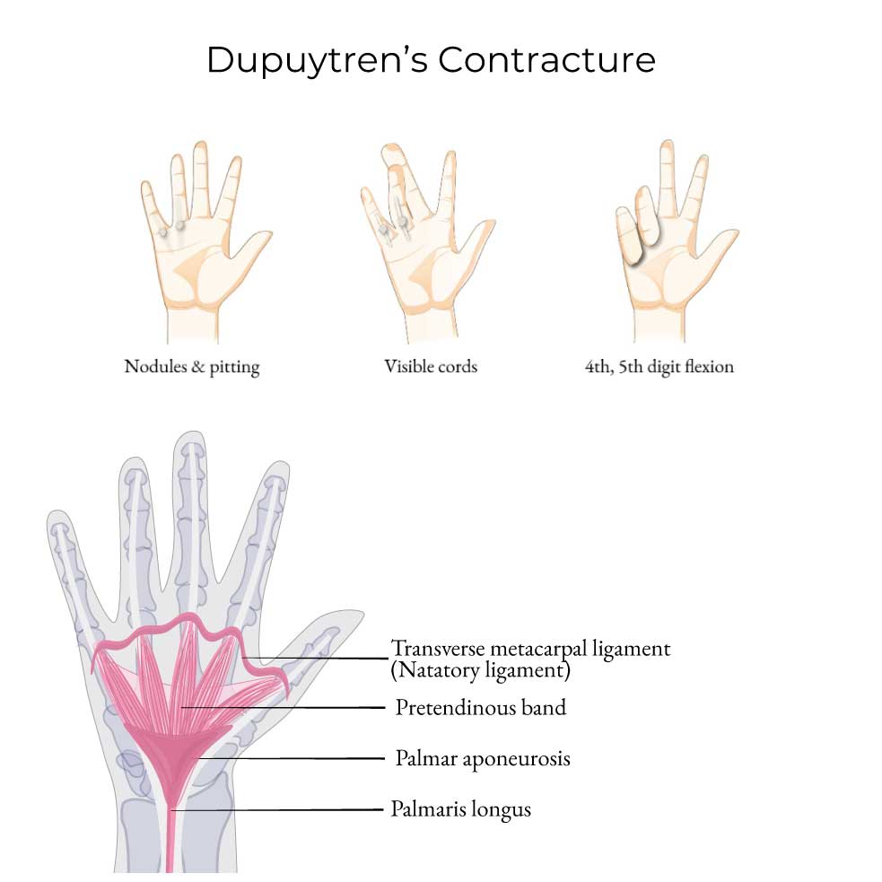 Clinical Medicine: Joint Injuries - Upper Limb | ditki medical ...
