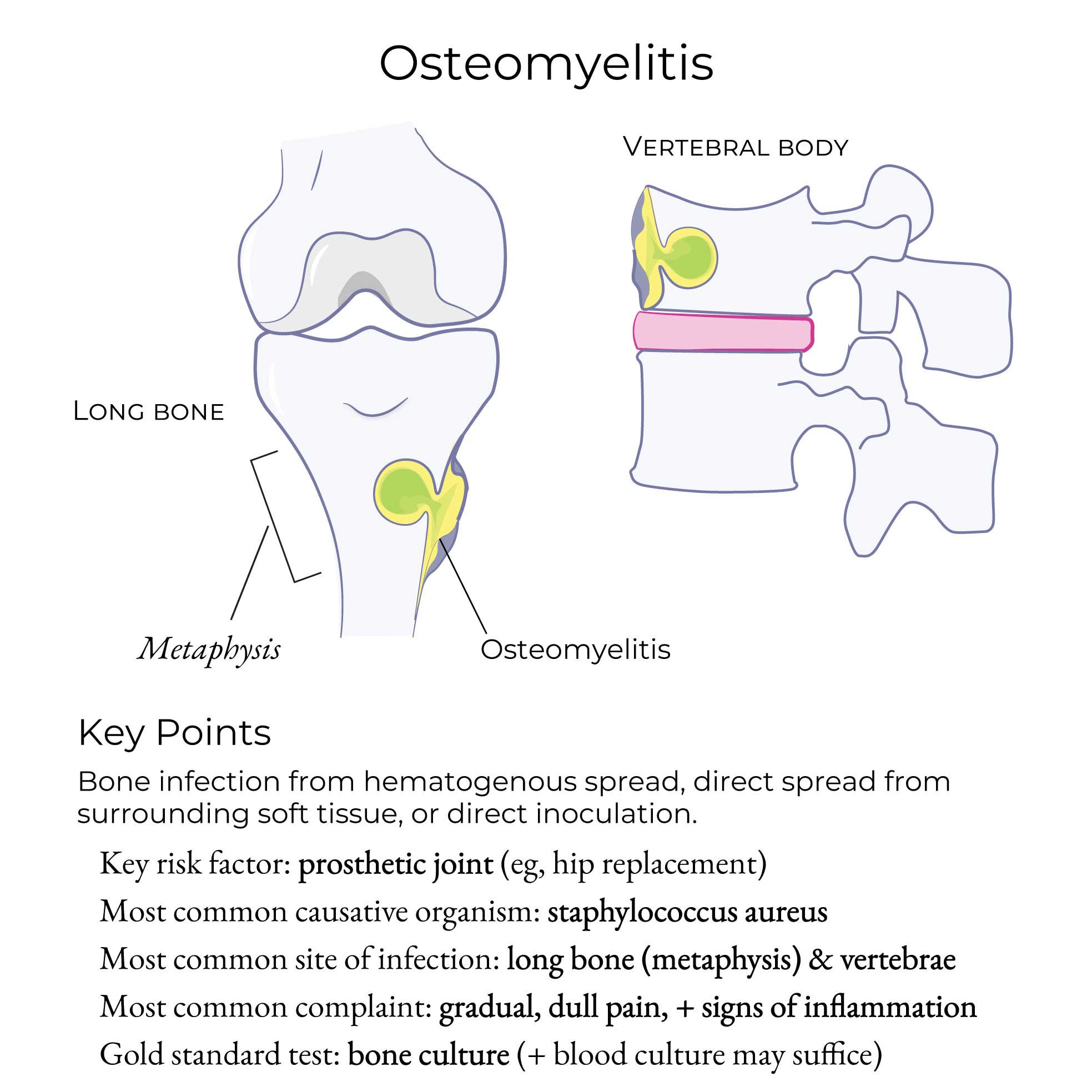 Clinical Pathology: Adult-Onset Bone Diseases | ditki medical ...