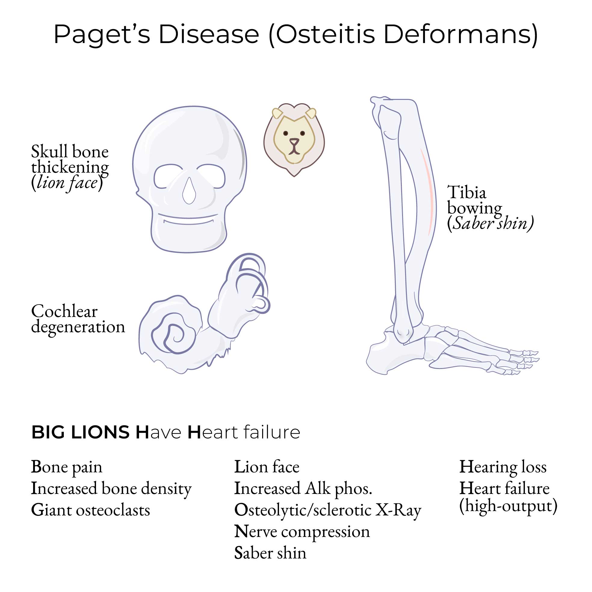 Clinical Pathology: Adult-Onset Bone Diseases | ditki medical ...