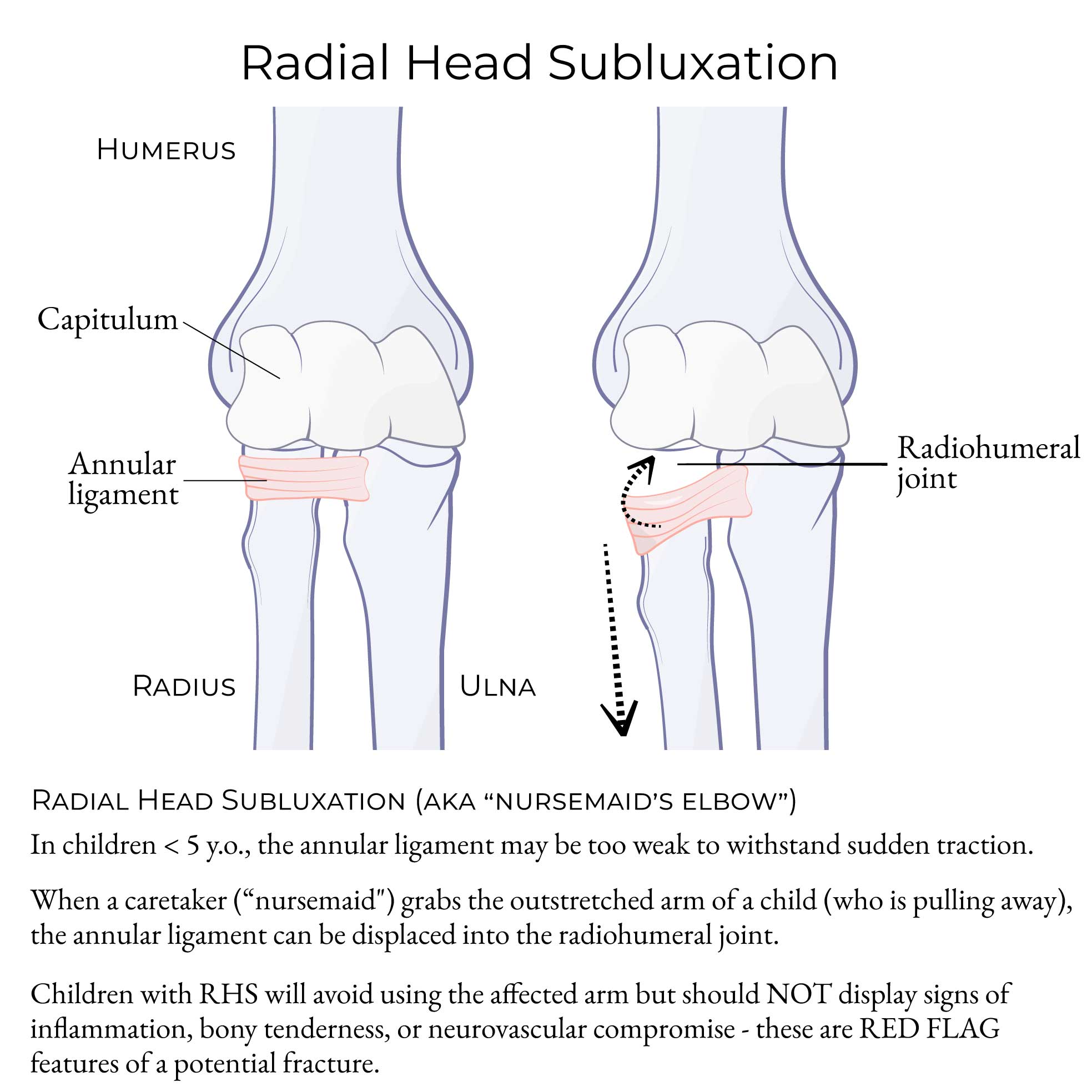 Clinical Pathology: Childhood-Onset Bone Diseases | ditki medical ...
