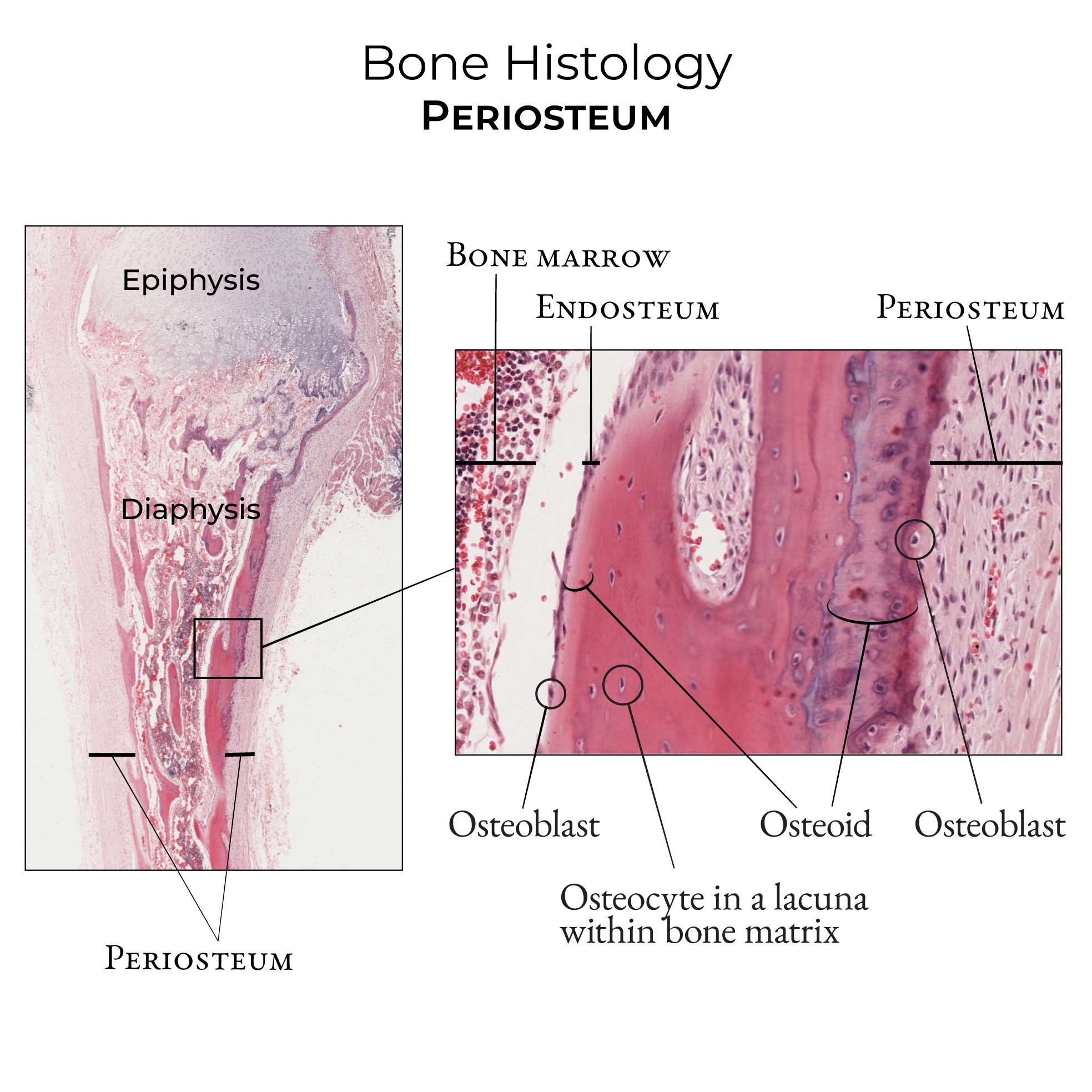 Endosteum And Periosteum Thickness